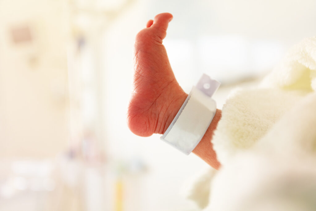Causes and Symptoms of Caput Succedaneum - Rosenbaum Personal Injury ...